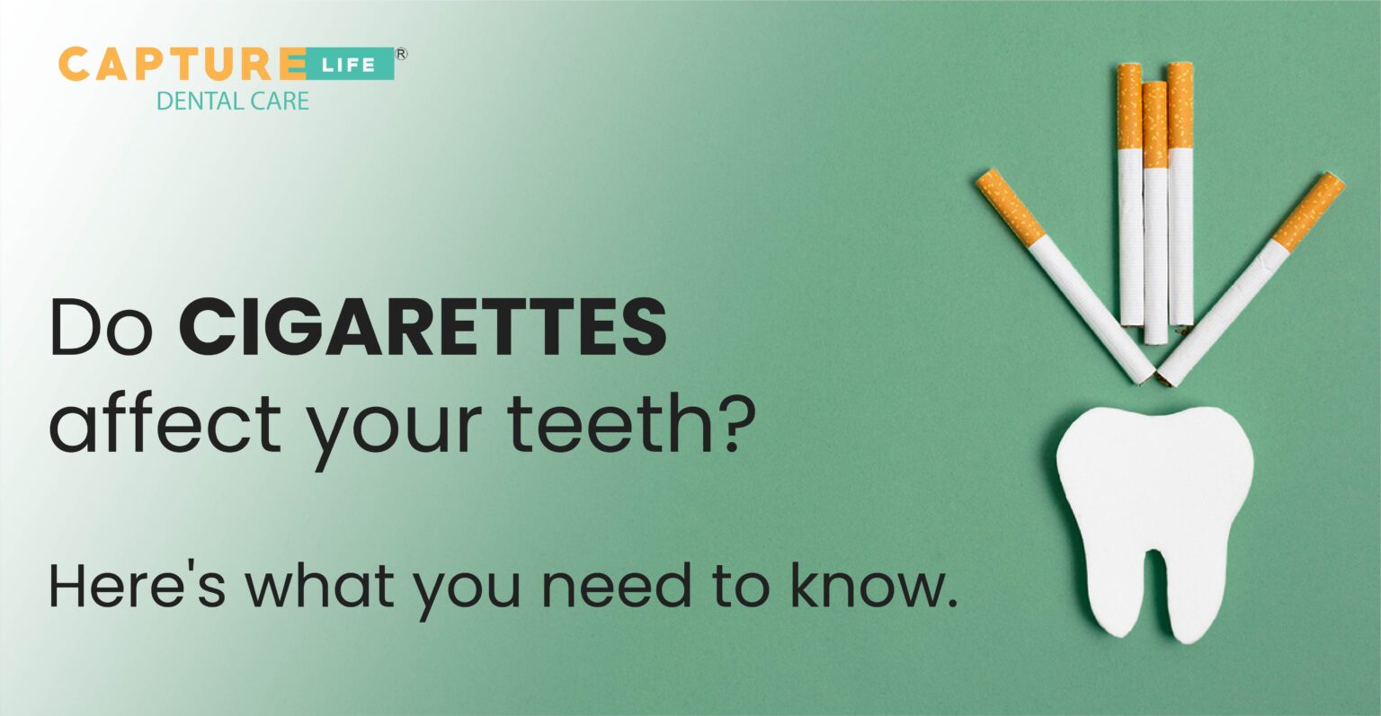 Do Smoker’s Smile? How Cigarettes Damage Your Teeth & Gums (CLDC ...